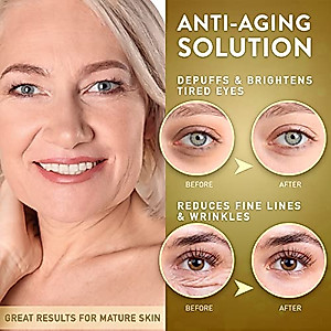 Wild Beauty Under Eye Patches (36 Pairs), Eye Masks for Dark Circles and Puffiness! Under Eye Patches for Under Eye Bags, 24K Gold Eye Mask, Under Eye Mask for Adults, Eye Patches for Puffy Eyes