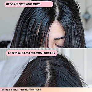 FoxyBae Volumizing Dry Shampoo Spray for Women - With Biotin for Hair Growth - For Dark, Brunette & Blonde Hair - Refreshing & Non-Toxic