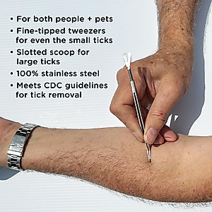 BUG BITE THING Tick Remover Tool for People & Pets, Patented Two Sided Stainless Steel Design with Fine Tipped Tweezers, Formerly Known as TickEase