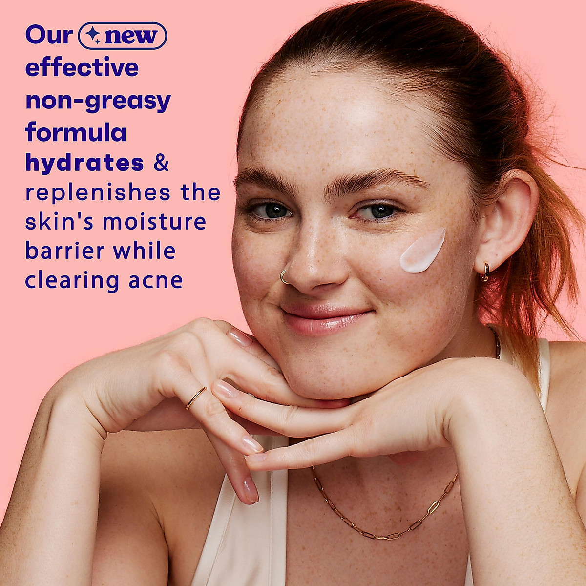 Clean & Clear Essentials Dual Action Oil-Free Facial Moisturizer, Salicylic Acid Acne Treatment with Pro-Vitamin B5 Moisturizes While Treating Acne & Helping to Prevent Pimples, 4 fl. Oz (Pack of 3)