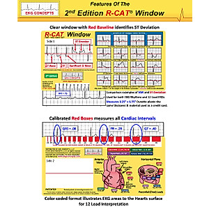 R-CAT EKG Window 2nd Edition