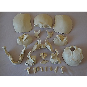 Wellden Medical Anatomical Adult Osteopathic Skull Model, 22-Part, Life Size, Bone Color