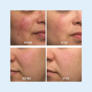 First Aid Beauty Ultra Repair Cream 14 oz jar