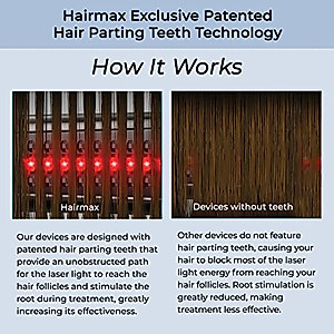 Hairmax Laser Hair Growth Comb (FDA Cleared), ULTIMA 9 Classic, Laser Hair Growth Treatment for Men & Women, Thinning Hair Treatment for Women and Men, Denser/Fuller Hair, Spot or Full Scalp, Hair Growth Products to Reverse Thinning Hair, 100% Medical Gra