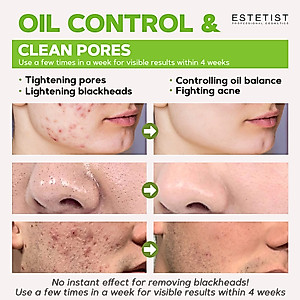 ESTETIST Green Tea Clay Mask Stick Set Purifying Face Mask Replenishing Moisture Deep Pore Cleanser Blackhead Remover Oil Control Skin Detoxifying Anti-Acne Treatment for All Skin Types Pack of 3