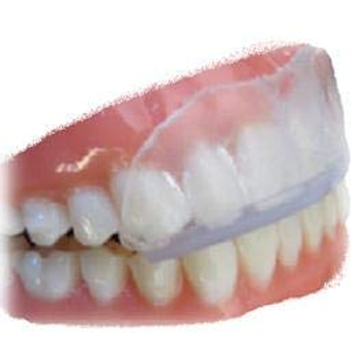 SmartGuard Dental Guard Night Guard for Clenching, Bruxism, and Grinding Dentist Designed Includes 2 Guards, 1 Travel Case, and a 60-Day Supply of Premium Cleaning Crystals