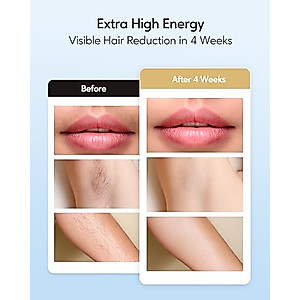 INNZA Laser Hair Removal with Ice Cooling Care Function for Women Permanent,999,999 Flashes Painless IPL Hair Remover, Hair Removal Device for Armpits Legs Arms Bikini Line (1-White)