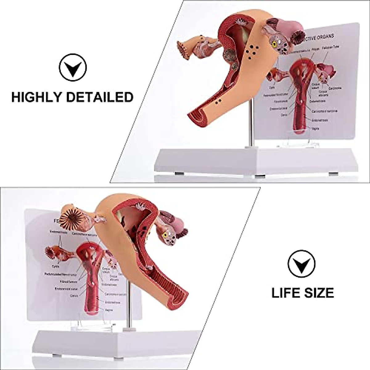 ROLTIN Human Pathological Uterus Model Internal Reproductive System Organ Anatomical Model Human Anatomy Model for Medical Training Aid