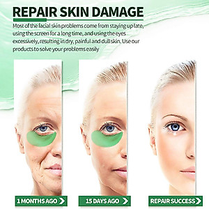 YiJiaBa Seaweed Under Eye Masks, Moisturizing, Nourishing, Improving Dark Circles, Whitening, Wrinkles, Provides Protein, Vitamins, Collagen, Hyaluronic Acid, 30 Pairs