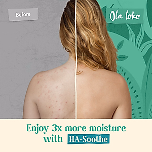 Coconut and Dead Sea Salt Body Scrub - Body Scrub Exfoliator, Scrubs & Body Treatments with Hyaluronic Acid & Vitamin E, Exfoliating Body Scrub to Moisturize & Remove Dead Skin, Exfoliating Scrub