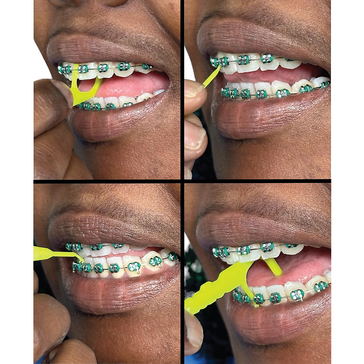 LBailar Braces Toothbrush Rechargeable with 4 Heads Bonus 2 AFTERCARE