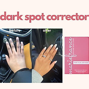 Pure Kojic Acid Soap for Hyperpigmentation, Dark Spots & Skin Brightening with Papaya Extract, Vitamin C & E - Maximum Strength, Fragrance-free, 5.3 oz