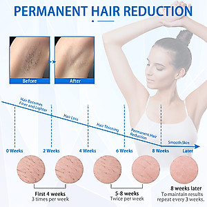 Permanent Hair Removal for Women & Men, 990,900 Flashes Painless IPL Sapphire Hair Removal Machine with Cooling Function for Full Body Permanent Results