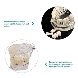 Smedent Dental Study Teaching Teeth Model Adult Typodont Model Removable Tooth