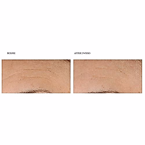 Dr Dennis Gross B³Adaptive SuperFoods™ Stress Repair Face Cream. For Dehydration, Redness, and Worry Lines, 2.0 fl oz