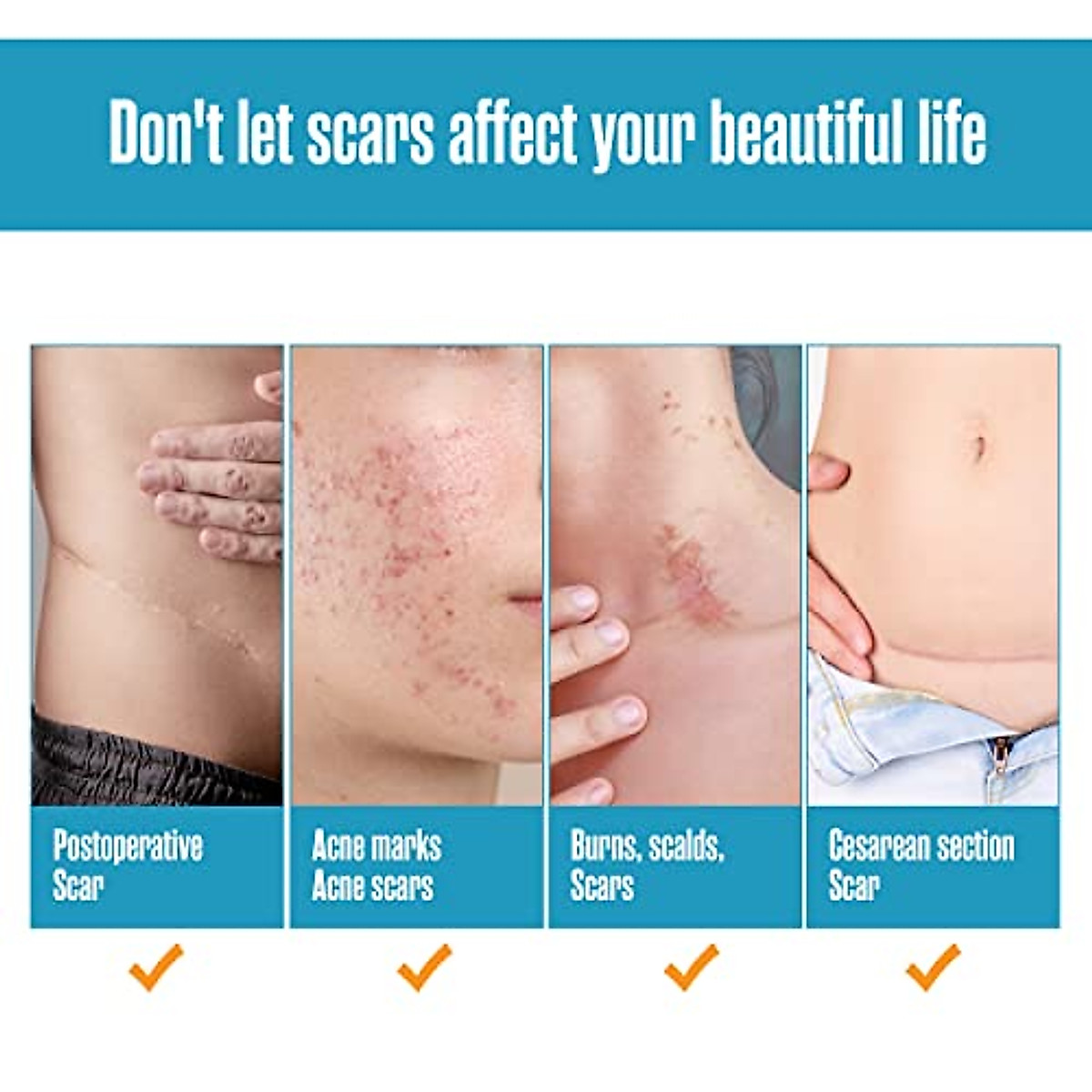 Silicone Scar Sheets, Soft Gel Tape, 1.57” x 60”, with 2” Perforations, Tan, Flexible, Medical Grade for Surgery, Keloids, Burns, Sensitive Skin, Wound Protection, Healing Patch | Houseables