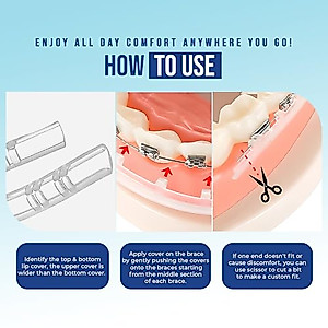 Comfort Cover Braces Guard/Lip and Mouth Protector - Snap on Cover Strip for Braces - Orthodontic/Dental Quality (Clear)