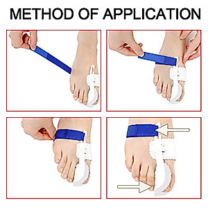 AnHua Valgus Bunion Corrector Orthotics Feet Bone Thumb Adjuster Correction Pedicure Sock Straightener Bunion Splint for Bunions For Crooked Toes Alignment Pain Relief (Style2：Blue white)