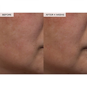 Glow Recipe PHA + BHA Face Toner - Skin Care Toner, Pore Minimizer & Gentle Face Exfoliant - Exfoliating, Soothing, Tightening & Hydrating Toner with Hyaluronic Acid & Watermelon (150ml)