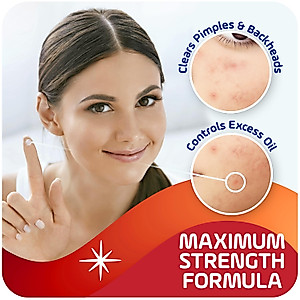 Asepxia Acne Treatment Cream for Face, 2% salicylic acid, Rapid Maximum Strength Acne Treatment, Clears Pimples and Blackheads, Prevents New Acne and Controls Excess Oil, 1 oz