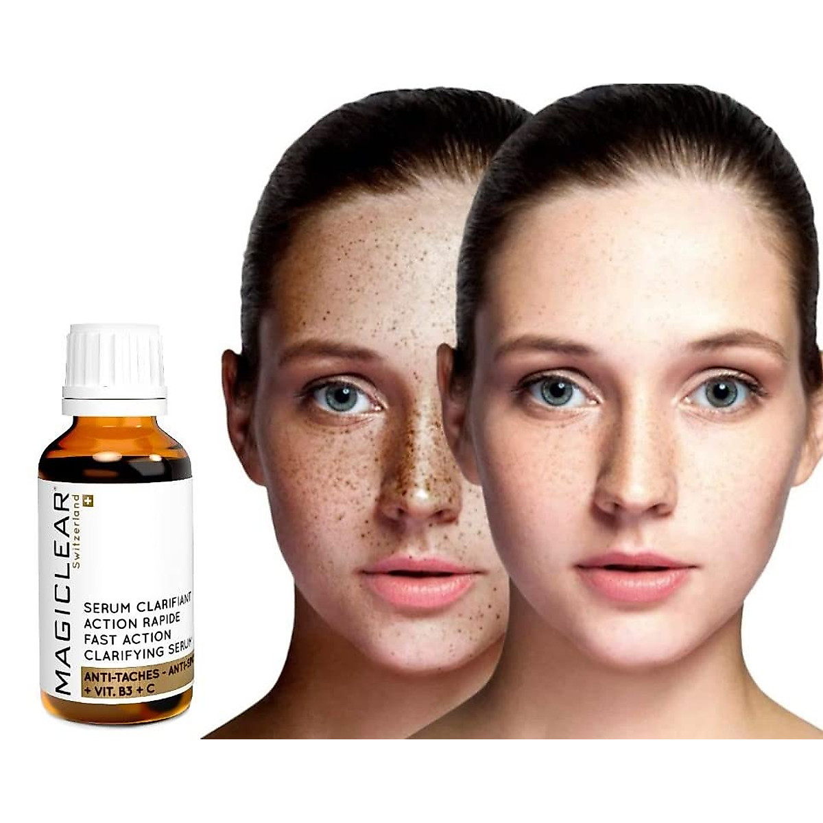 Luxury Dark spot remover for Face and Body Serum - Age spot corrector Acne scar - Anti aging - Bleaching Vitamin C organic Swiss brand Magiclear 30 ml