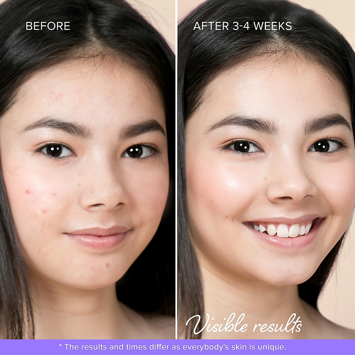 MAREE Star Pimple Patches for Face - Acne Patches - Natural Green Algae Extract & Tea Tree Oil - Hydrocolloid Stars Cute Zit Stickers, Parches Para Acne - 72 Marine Collagen Blemish Pimple Dots