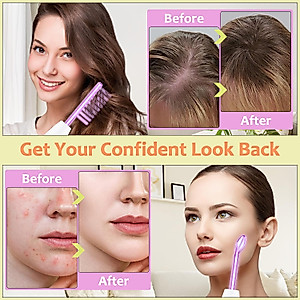 High Frequency Facial Wand - Uaike 4 in 1 Violet Portable Handheld High Frequency Facial Machine - at Home Face Skin Wand Device with 4 Pcs Purple Glass Tubes