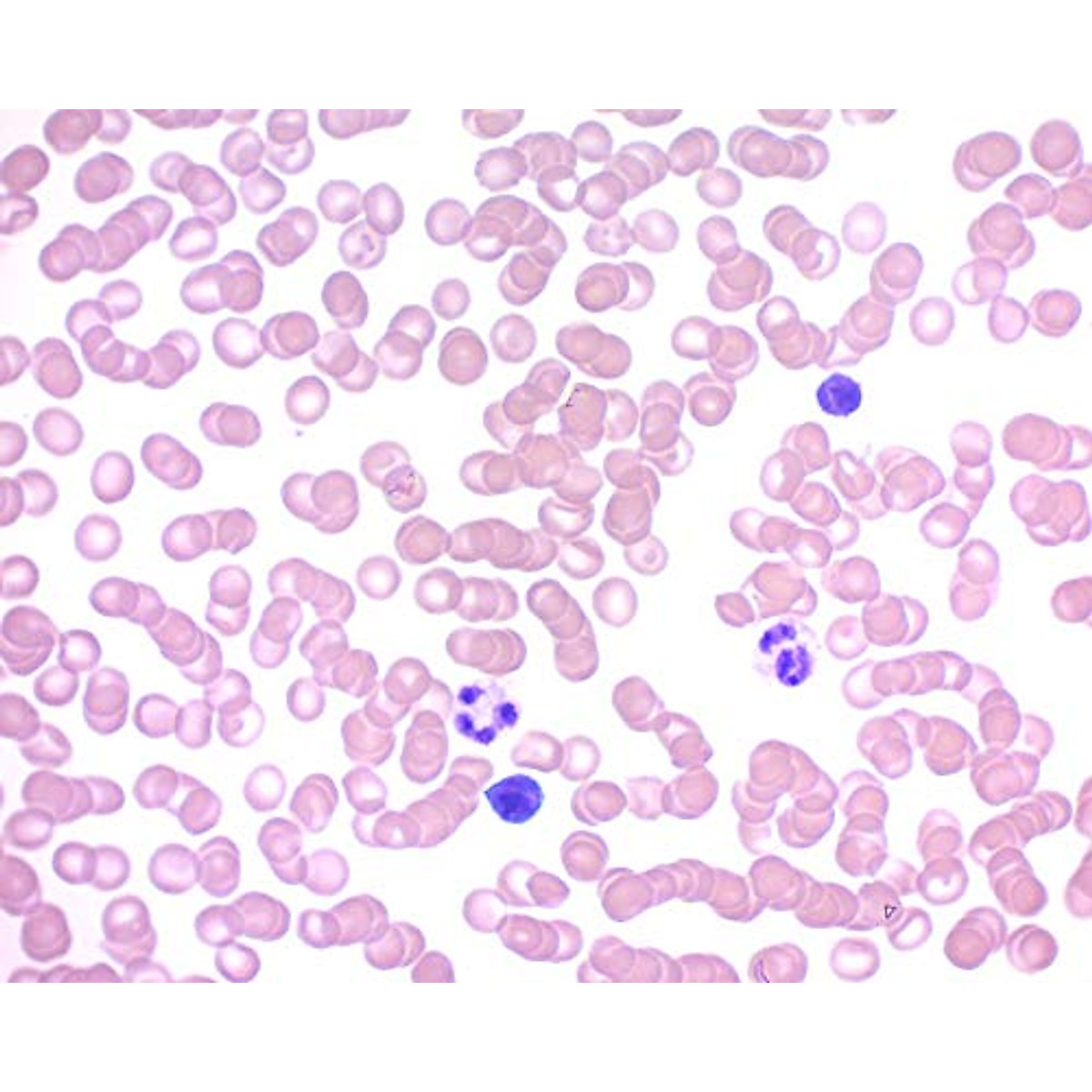 Quick-Dip Differential Stain Pack, 500ml