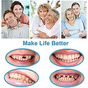 Healthyare Tooth Repair Kit-Temporary Fixing Missing and Broken Tooth Fake Teeth, 60 Piece Assortment