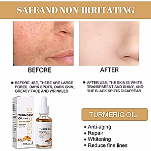 2022 New Turmeric Dark Spot Corrector Serum，Natural Turmeric Dark Spot Corrector Serum for Face， Skin Care Moisturizing Repair Serum(2PCS-60ml)