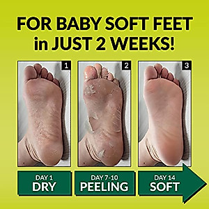 FARMSKIN Foot Peel Mask Clearing / Removes Dry Dead Skin for Cracked Feet / foot mask for soft baby feet with Tea Tree, Cica / Dermatologically Tested (Pack of 3)