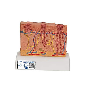3B Scientific J15 Skin Cancer Model - 3B Smart Anatomy