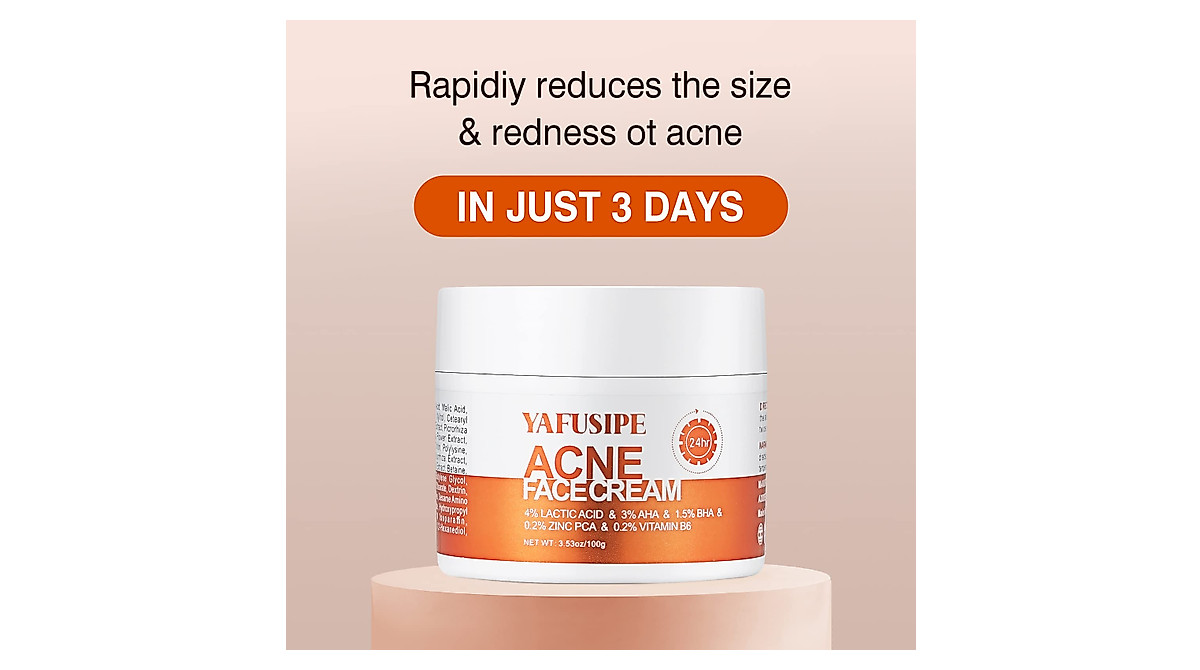 Effective Acne Treatment Cream for Face & Body