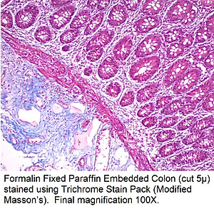 Trichrome Stain Pack (Modified Masson’s), 125ml