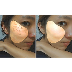 WHITESILK(𝟐𝟎𝟐𝟒 𝐔𝐩𝐠𝐫𝐚𝐝𝐞𝐝) Anti-Aging Skin Boosting SCM75 + HGF (Advanced +) Human Stem Cell 750,000ppm Super Ampoule, with SCM-3D Biomimetic Technology (10ml x 5 vials, 1.69oz)