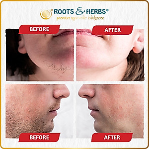 Chickpea & Kasturi Turmeric Facial Hair Removal Powder - For Men & Women, Chin, Jawline & Upper Lips - Depilatory Mask with Ayurvedic Herbs - Roots & Herbs, 2.11oz