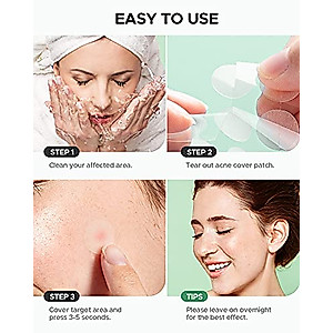 ZATKTK Acne Pimple Patch (180 Counts 4 Sizes), Invisible Hydrocolloid Acne Patch with Tea Tree Oil & Calendula Oil, Acne Spot Healing Patch Zit Patches for Face