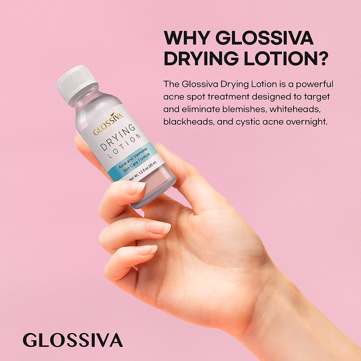 Glossiva Drying Lotion – Acne Spot Treatment, Blemish & Pimple Drying Solution with Overnight Results – 1.23 Fl Oz