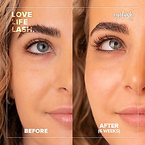 Eyelash Growth Serum Premium Lash Serum (7ml) Physician Developed - For Longer, Thicker, Healthier Natural Lashes - Lash Extensions Safe, Oil-free -6 Months Supply, 4-6 Weeks Results