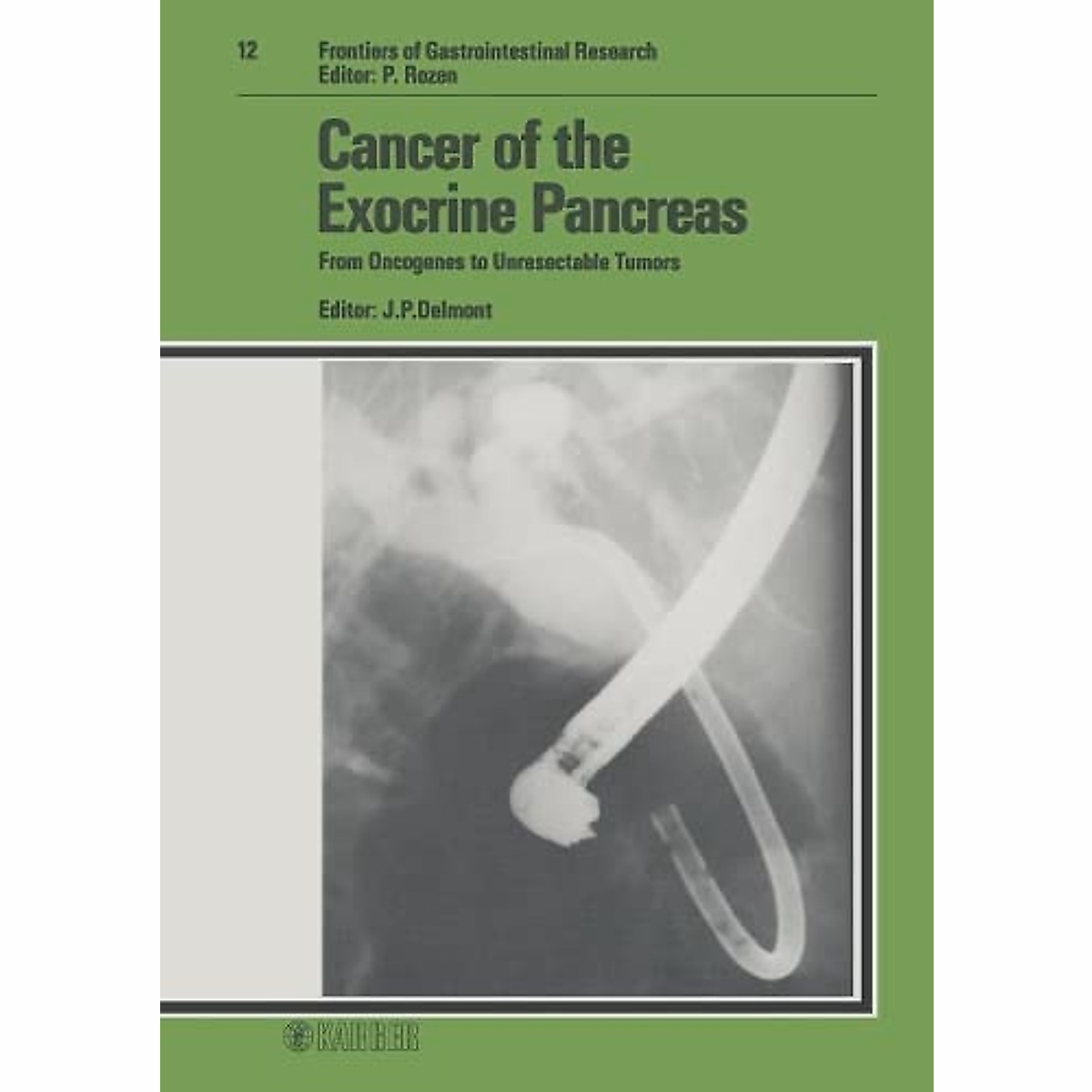 Cancer of the Exocrine Pancreas: From Oncogenes to Unresectable Tumors (Frontiers of Gastrointestinal Research)