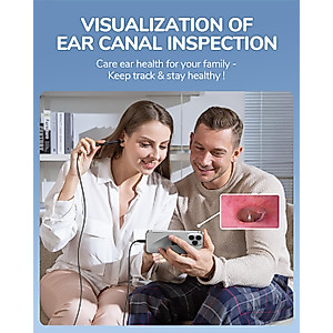 ScopeAround Otoscope Ear Camera, Ear Wax Removal Tool 1080p FHD Video Otoscope, 3.9mm Ear Wax Removal Camera with 6 LED Lights Visual Ear Scope, Compatible with iPhone15 & Android