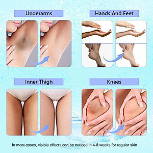 Body Intimate Area Dark Remover For Underarms, Armpit, Knees, Elbows, Inner Thigh, bikini Dark Area Corrector Cream With Natural-Ingredients Designed By USA