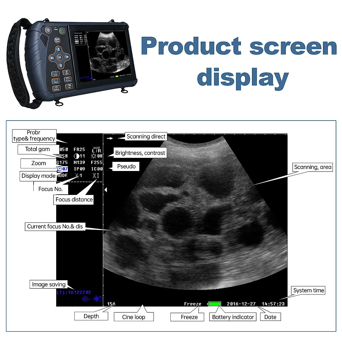 Aopuoe Portable Ultrasound Scanner for Veterinary, with 3.5Mhz Convex Probe, for Pig/Dog/Sheep/Tiger/Bear/and Other Medium-Sized Animals Use