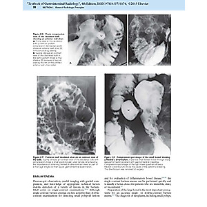 Textbook of Gastrointestinal Radiology, 2-Volume Set