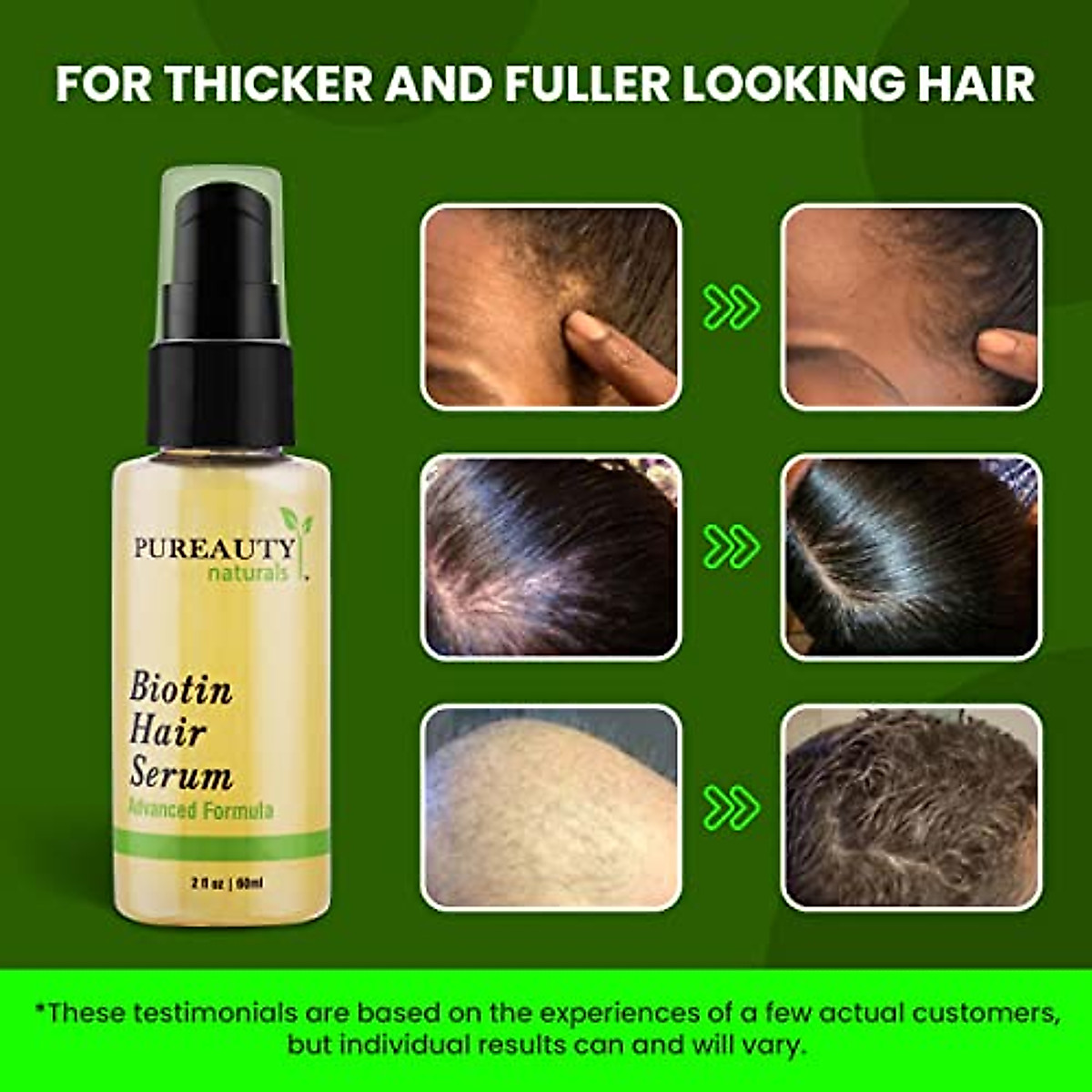 Biotin Hair Growth Serum - Biotin serum & Hair growth oil and hair serum - Topical hair growth product for thicker looking hair growth for women & men hair loss serum - Biotin oil by Pureauty Naturals