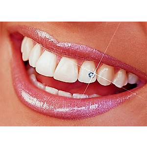 SmileWorld Blue Gel 36 Gm kit - Desmineralization Gel 35 Percent -Dental Etch - Perfect Viscous-Stays Where Placed- Includes Lip Expander - Not Glue - Made in USA (3) Units