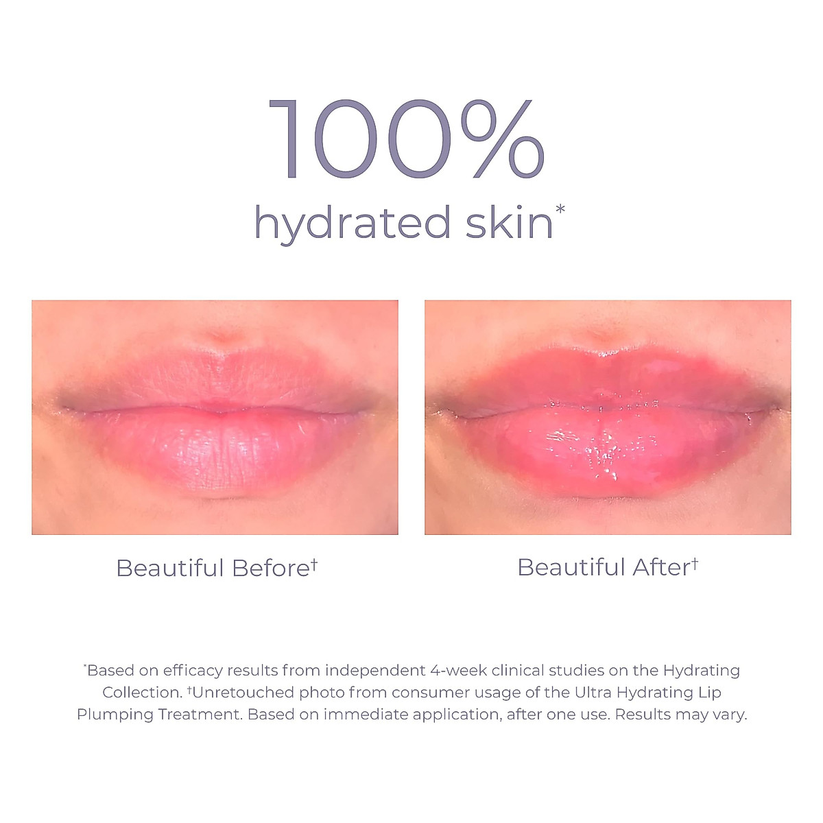 DERMA E Ultra Hydrating Lip Plumping Treatment – Advanced Lip Plumper for Enhanced Fullness and Natural Color – Lip Moisturizer with Hyaluronic Acid, Cinnamon and Jojoba Oil, 0.34 Fl Oz