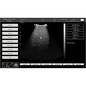 Portable Vet Veterinary B-Ultrasound Scanner，for Pregnancy，with Convex Probe for Horse,Goat,Cow,Sheep and Pig, CMS600P2 Vet CONTEC(Convex Probe)