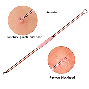 Blackhead Remover Pimple Comedone Extractor Tool, Effective Acne Removal Kit, Treatment for Blemish, Whitehead Pimple Popping, Zit Removing for Nose & Face Skin, Best Electroplated 4 PCS w/case.