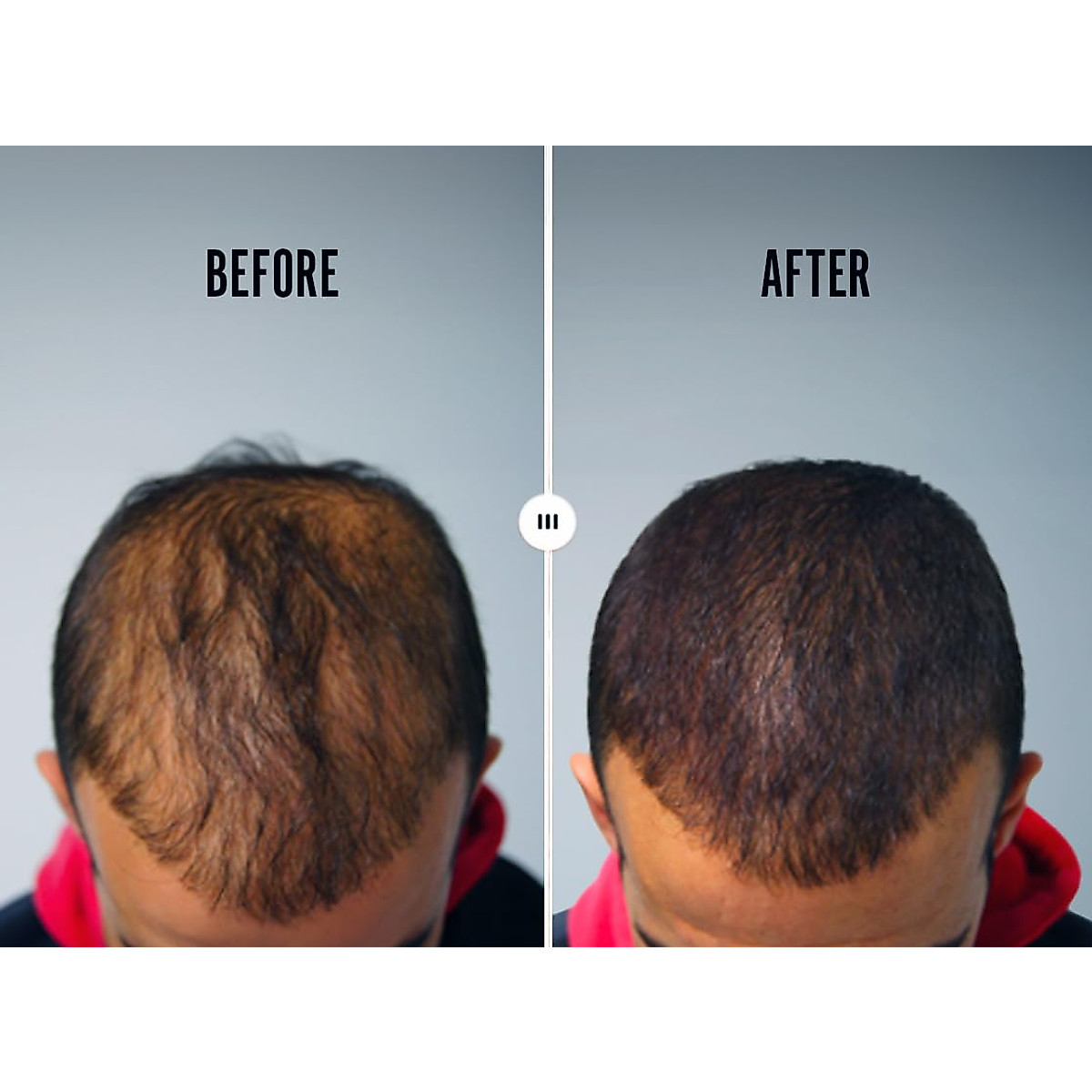 Revivogen MD Scalp Therapy Thinning Hair Solution and Bio-Cleansing Shampoo Set